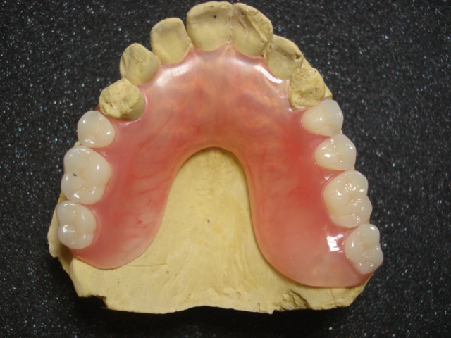 Streamline Dental Lab - Manhattan, New York - Gallery - Dentures - Tcs ...