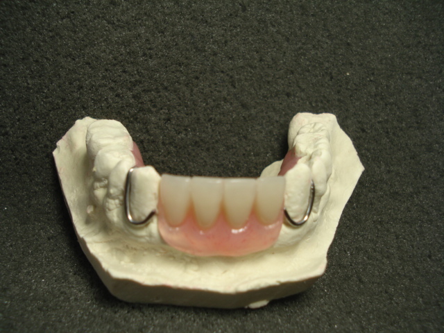 Streamline Dental Lab - Manhattan, New York - Gallery - Dentures ...