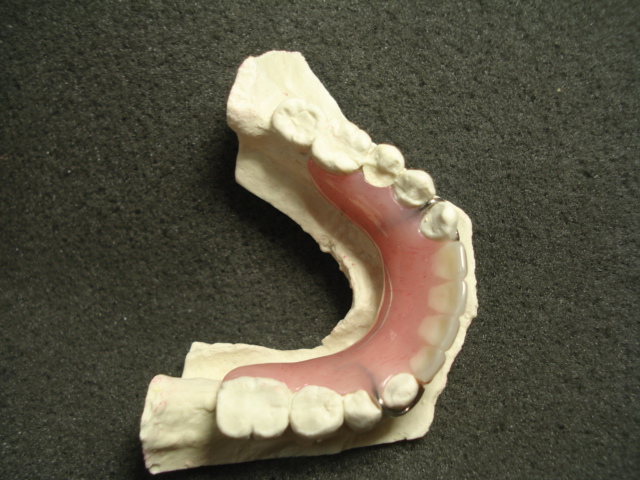 Streamline Dental Lab - Manhattan, New York - Gallery - Dentures ...