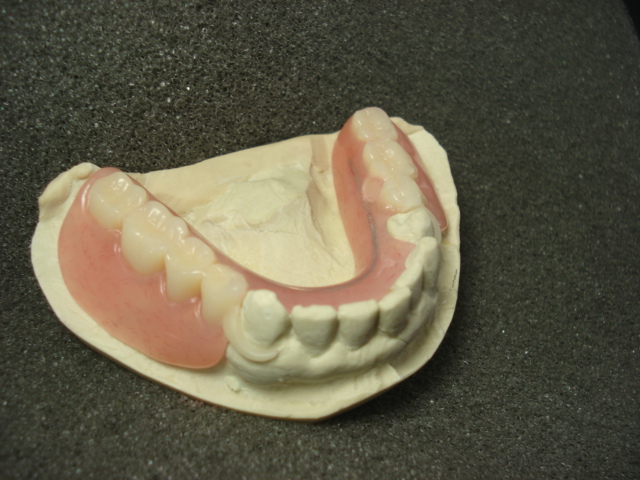 Streamline Dental Lab - Manhattan, New York - Gallery - Dentures ...