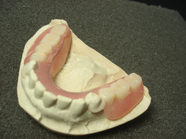 Streamline Dental Lab - Manhattan, New York - Gallery - Dentures ...