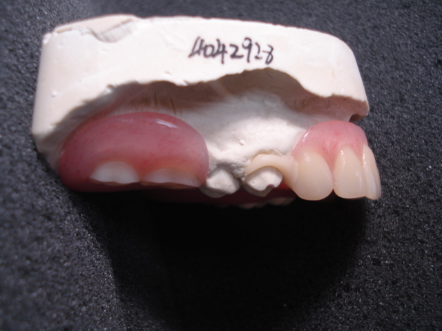 Streamline Dental Lab - Manhattan, New York - Gallery - Dentures ...