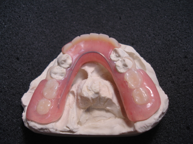 Streamline Dental Lab - Manhattan, New York - Gallery - Dentures ...