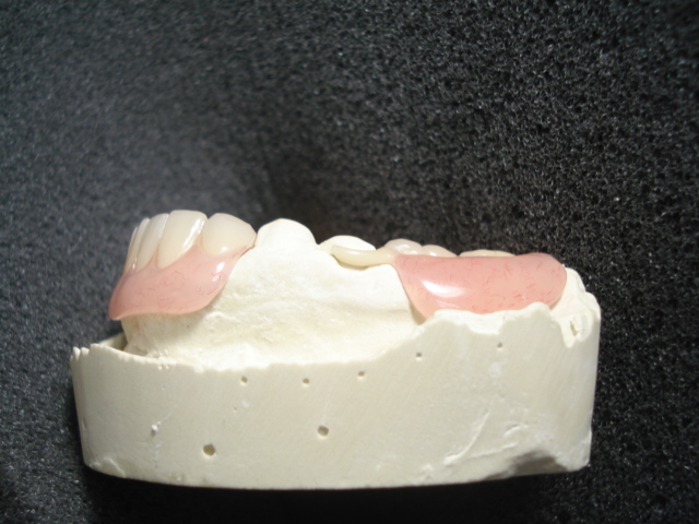 Streamline Dental Lab - Manhattan, New York - Gallery - Dentures ...