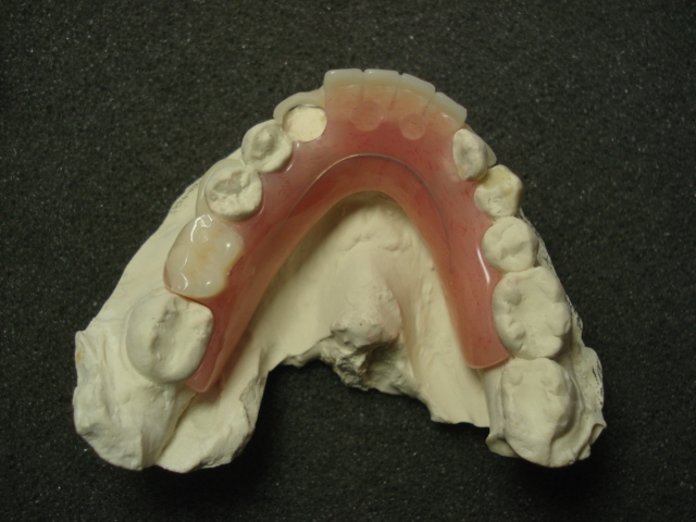 Streamline Dental Lab - Manhattan, New York - Gallery - Dentures ...