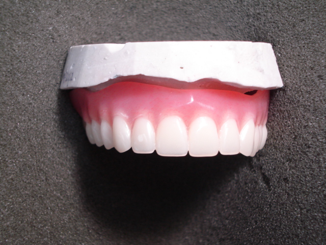 Streamline Dental Lab - Manhattan, New York - Gallery - Dentures - Full ...