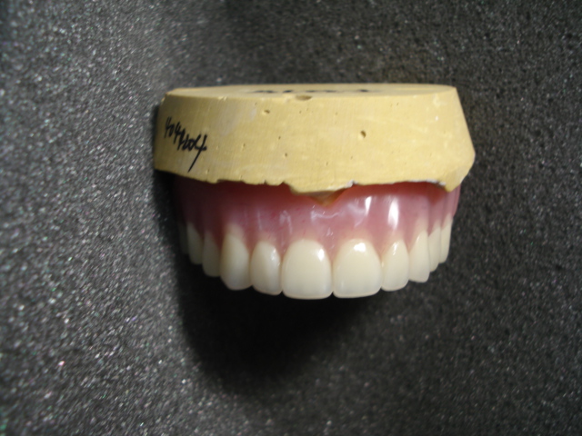 Streamline Dental Lab - Manhattan, New York - Gallery - Dentures - Full ...