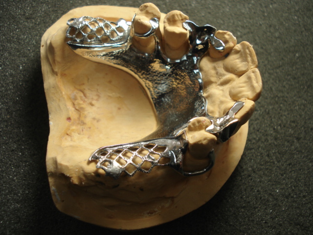 Streamline Dental Lab - Manhattan, New York - Gallery - Dentures ...