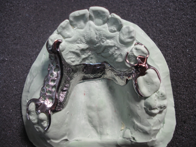 Streamline Dental Lab - Manhattan, New York - Gallery - Dentures ...