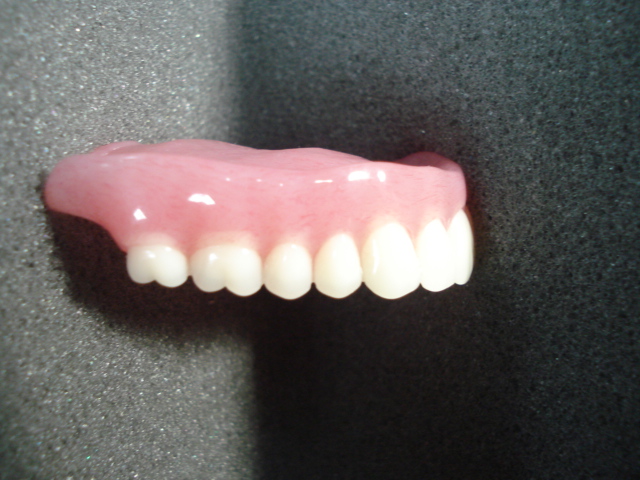 Streamline Dental Lab - Manhattan, New York - Gallery - Dentures - Full ...