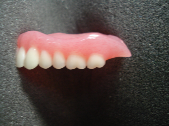 Streamline Dental Lab - Manhattan, New York - Gallery - Dentures - Full ...