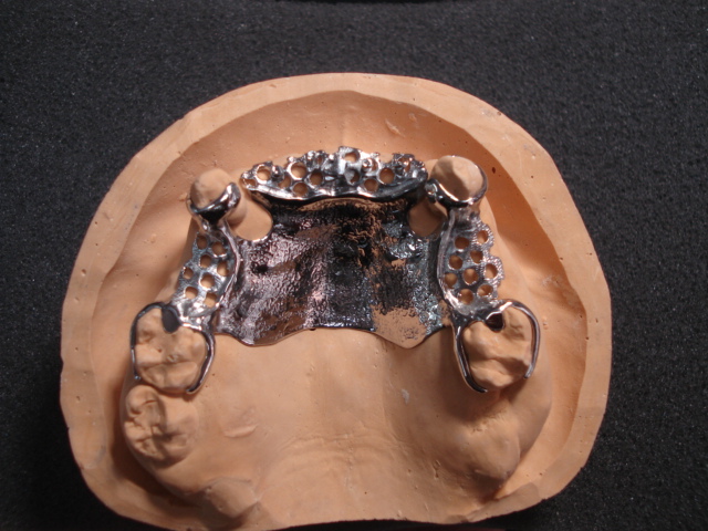 Streamline Dental Lab - Manhattan, New York - Gallery - Dentures ...