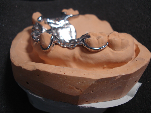 Streamline Dental Lab - Manhattan, New York - Gallery - Dentures ...