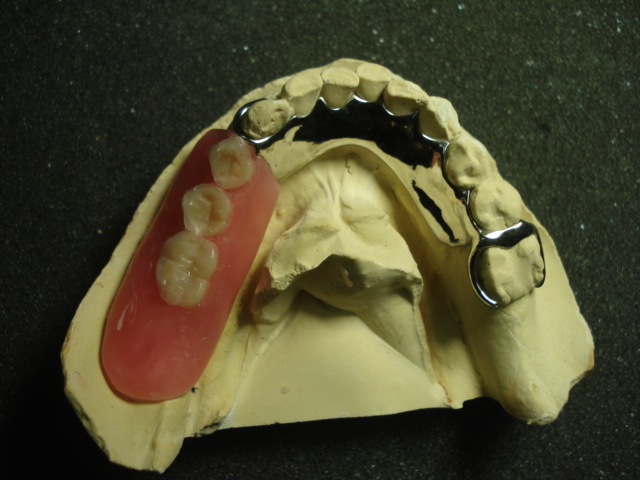 Streamline Dental Lab - Manhattan, New York - Gallery - Dentures ...